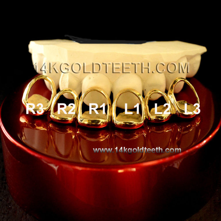 Silver Plated 18K Gold Teeth Open Face Single Cap Grillz - Y 80002