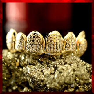 Custom Gold Grillz - Shop Gold Teeth Online