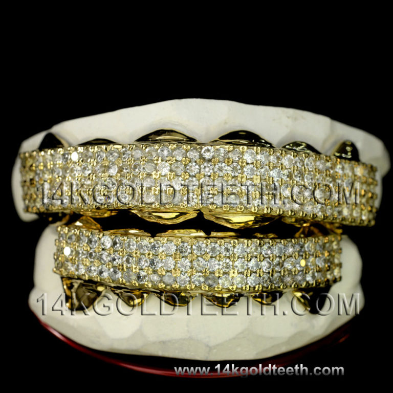 Iced Out Yellow Gold Teeth Grillz - IC 40006